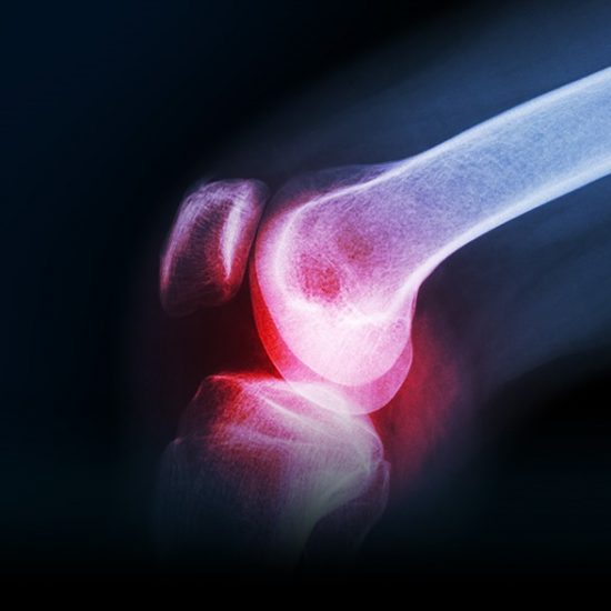 Multispecialty Hospital in Mumbai | Horizon Prime Hospital